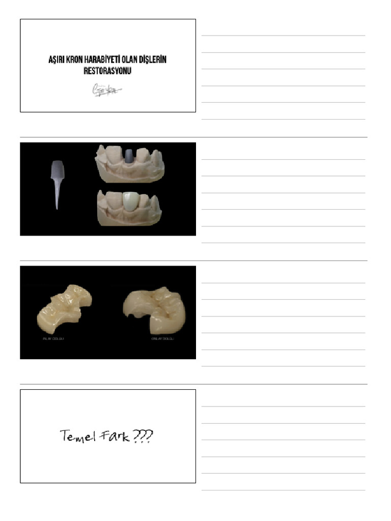 İnlay-Onlay Restorasyonlar | PDF