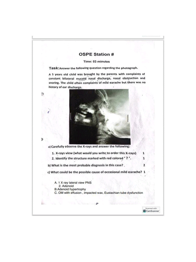 Ent Osce - (Nasir) | PDF