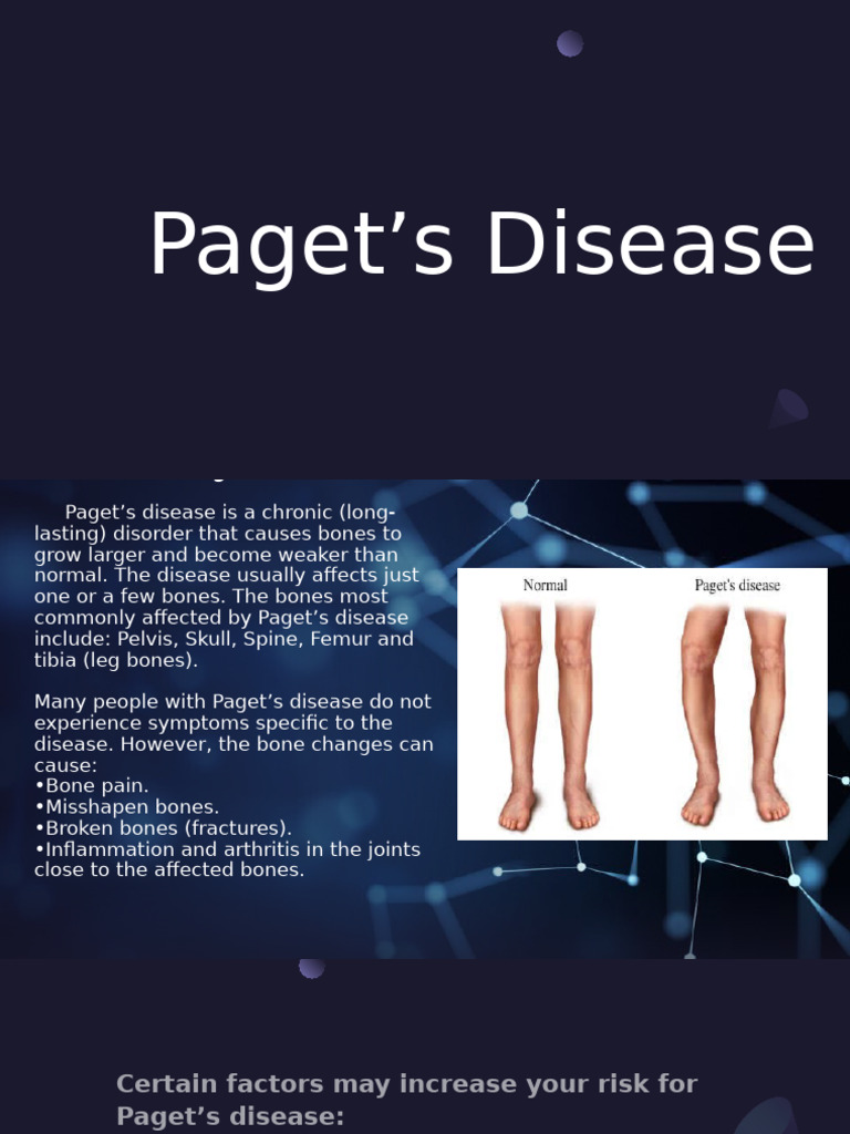 Pagets-Disease | PDF | Arthritis | Bone
