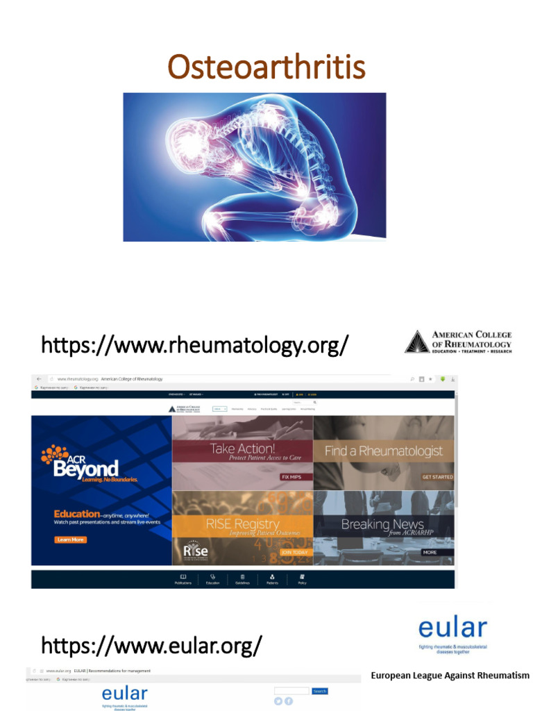 Osteoarthritis Pdf Osteoarthritis Joint