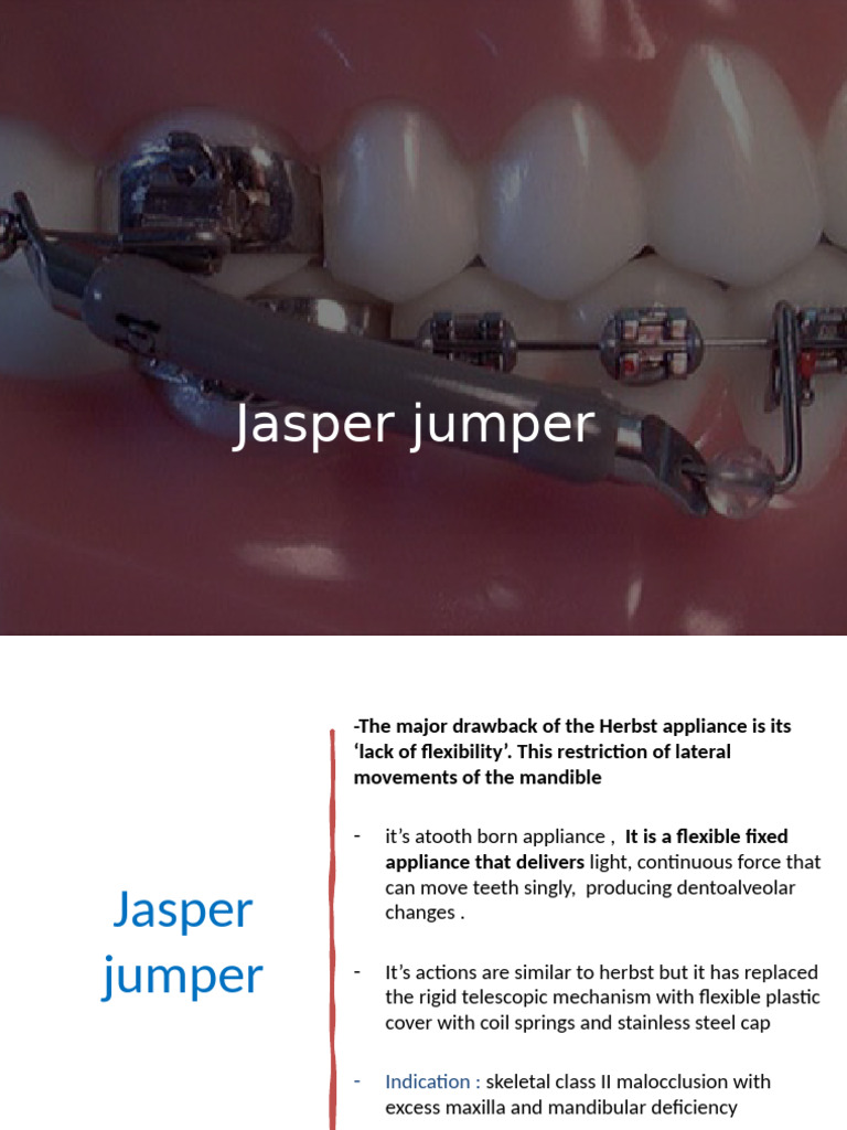 Jasper Jumper | PDF | Mouth | Dental Anatomy