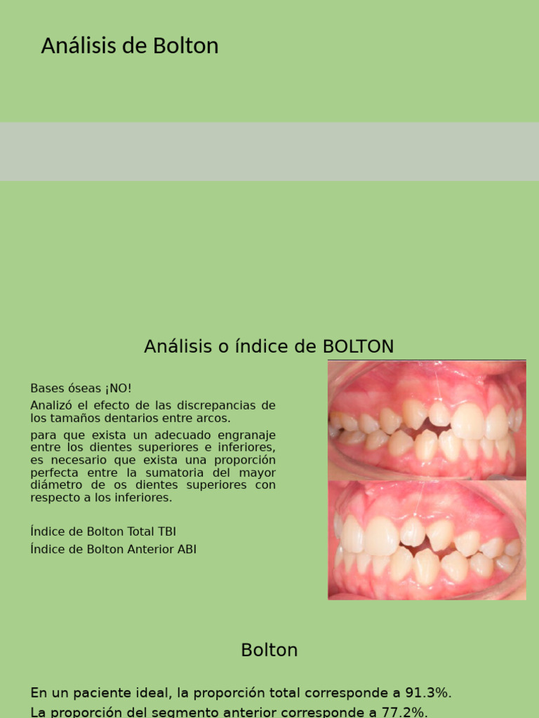 Analisis de Bolton | PDF