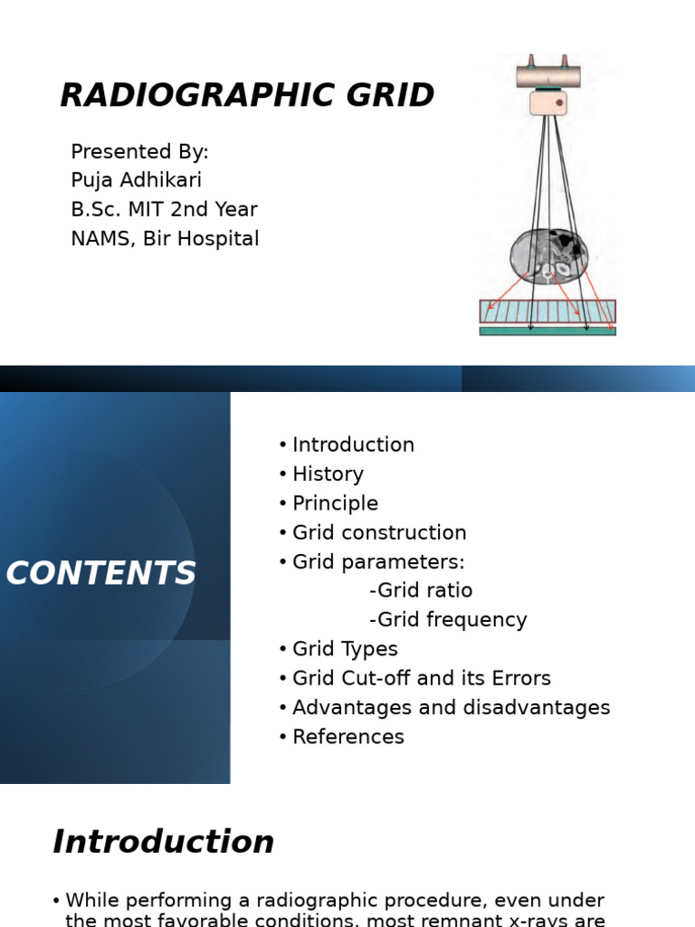 RADIOGRAPHIC GRIDS | PDF | Radiography | X Ray