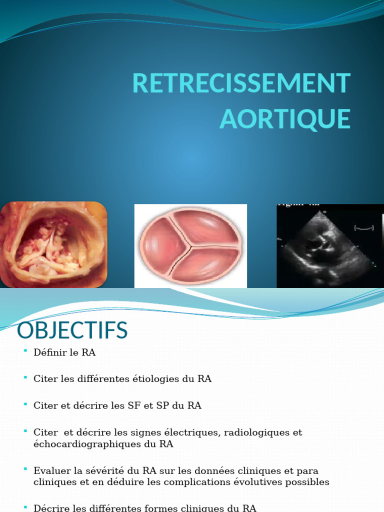 Rétrécissement Aortique : Évaluation et Traitement | PDF | Insuffisance ...