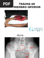 Prueba de Adams | PDF | La columna vertebral | Escoliosis