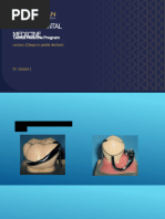 Types and Indications of Clasp Assemblies | PDF | Mouth | Dentistry ...