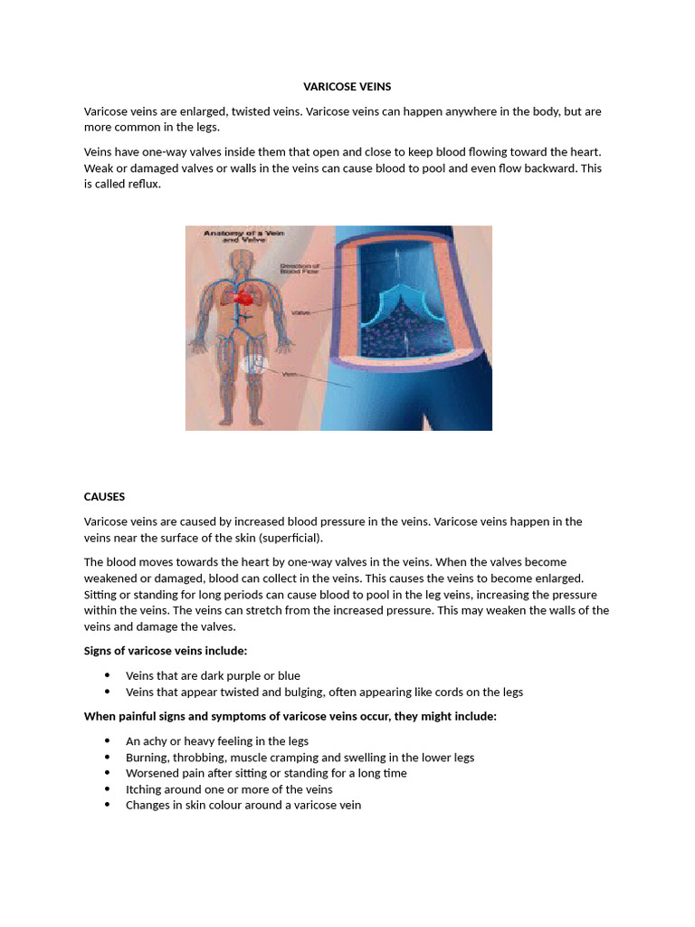 Understanding Varicose Veins: Causes & Treatments | PDF | Wellness ...