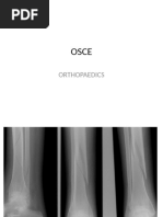 Musculoskeletal MSK X-Ray Interpretation OSCE Guide | PDF | Bone ...