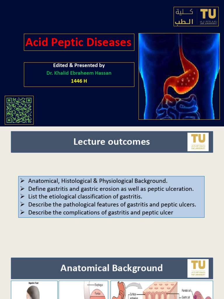 Understanding Acid Peptic Diseases | PDF | Stomach | Inflammation