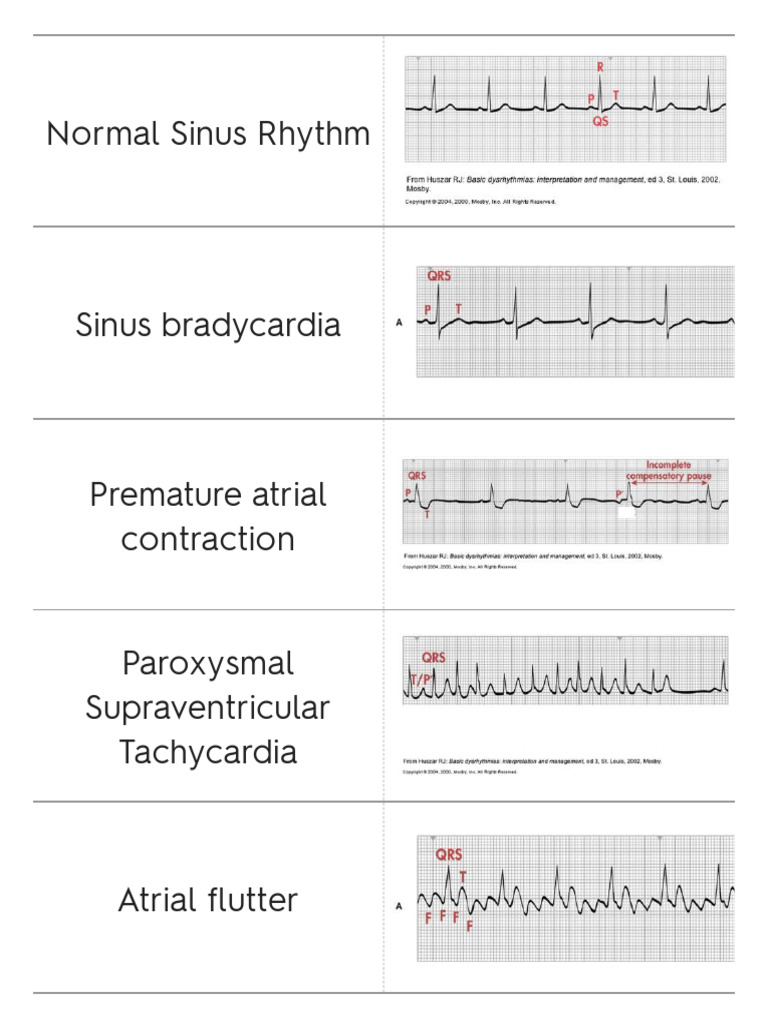 Ecg Important Question | PDF | Art | Religion & Spirituality
