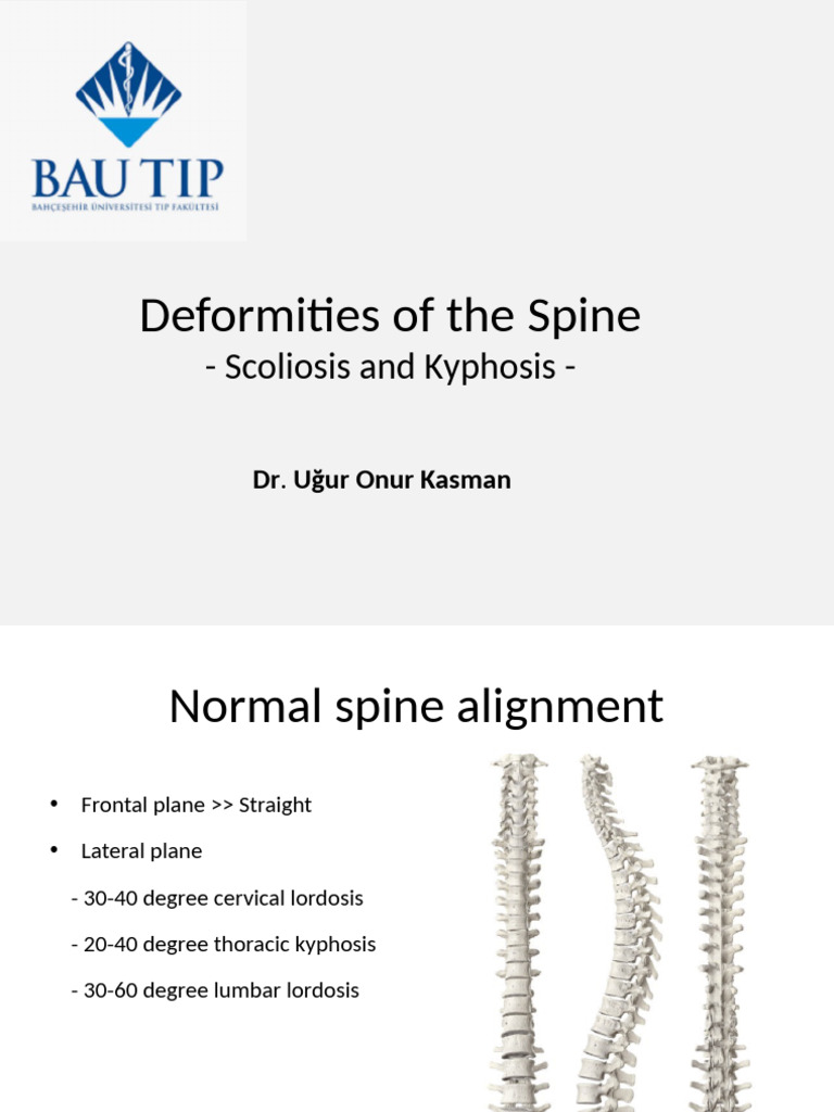 Spinal Deformities Third | PDF | Scoliosis | Vertebral Column