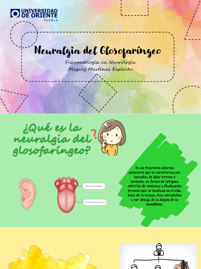 Neuralgia Del Glosofaríngeo | PDF | Dolor | Nervio
