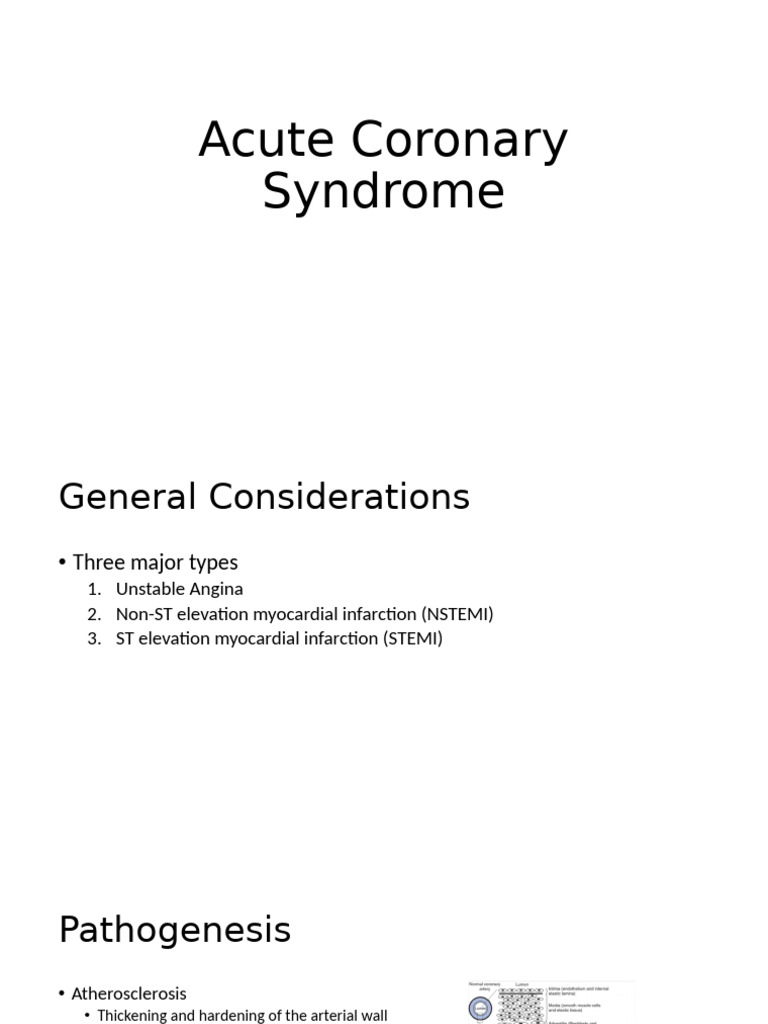 Acute Coronary Syndrome | PDF | Myocardial Infarction | Percutaneous ...