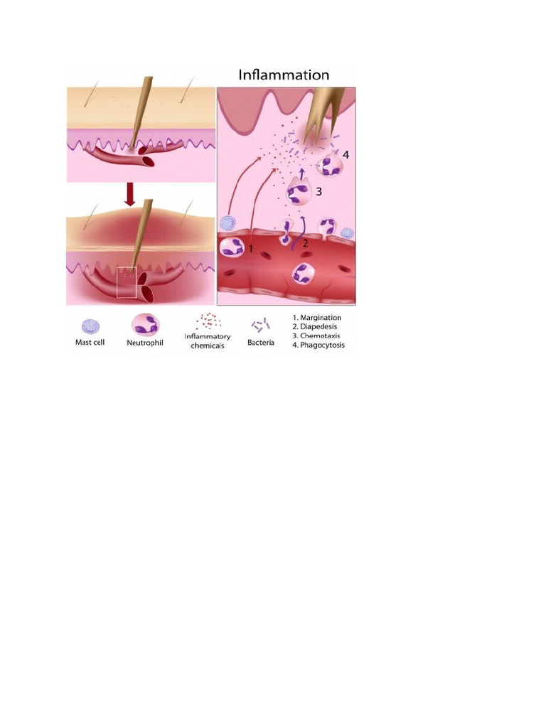 Skin Rash Diagram | PDF