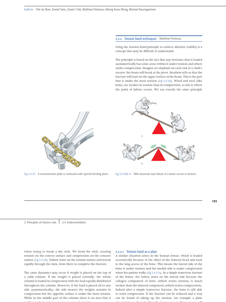Tension Band Wiring | PDF | Knee | Limbs (Anatomy)