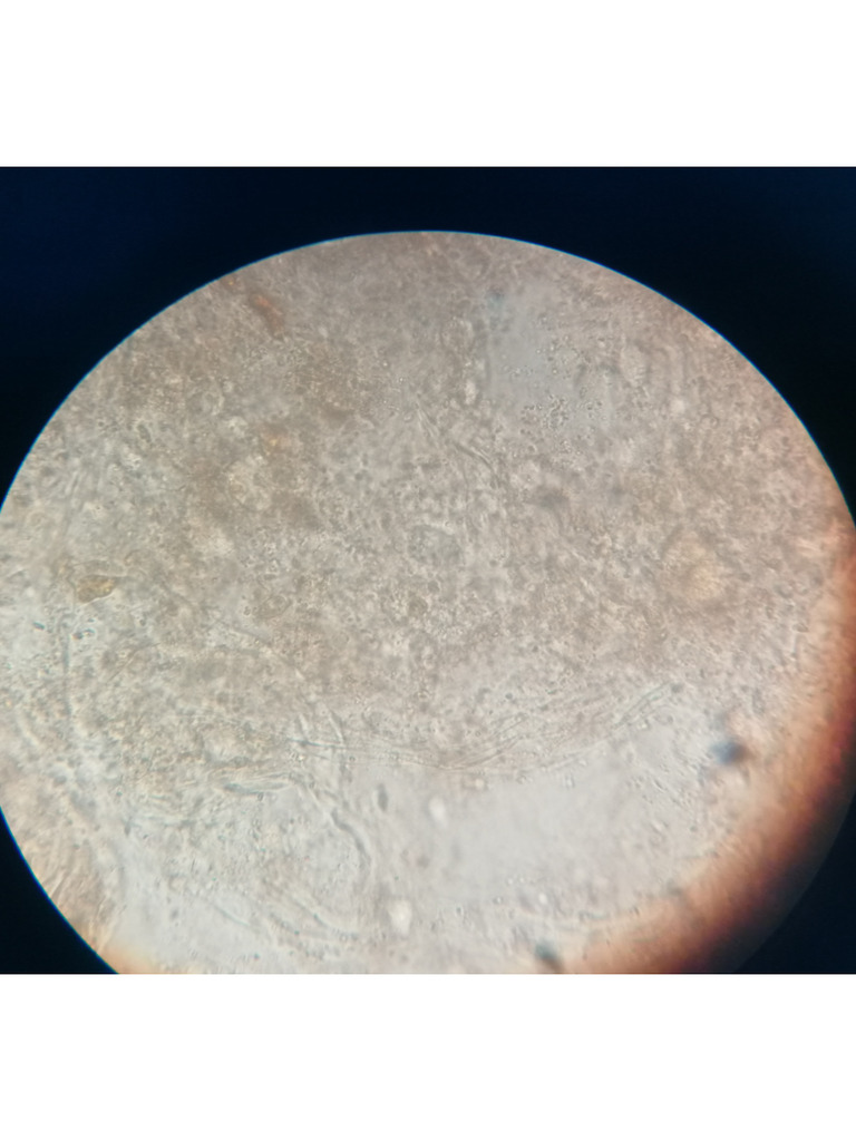 Aa Micelio de Hongo A 40x | PDF