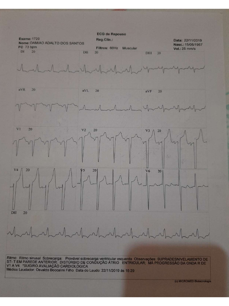 Laudo Eletrocardiograma | PDF