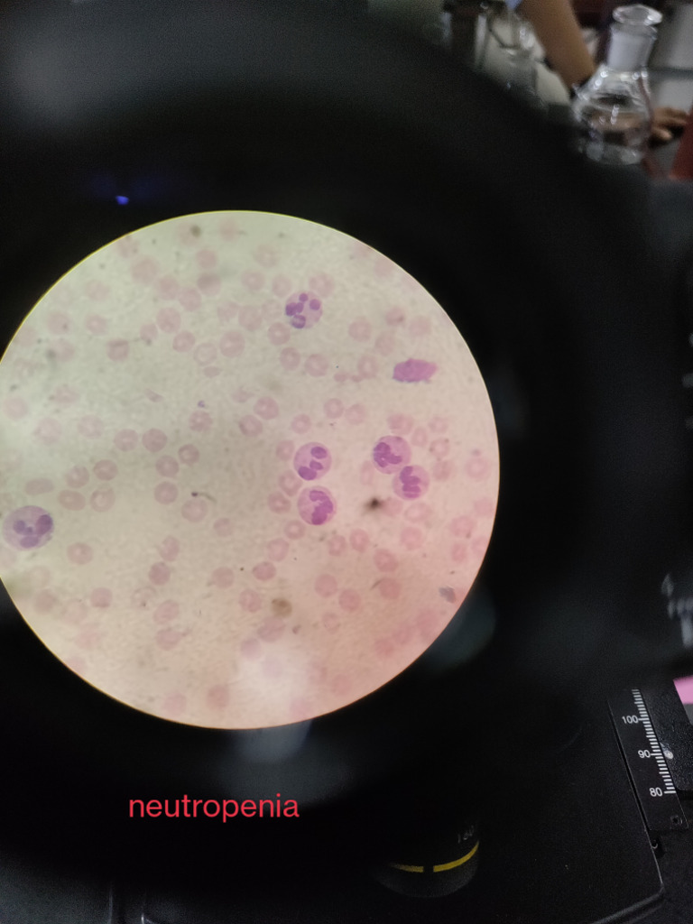 Latest Patho Slides | PDF