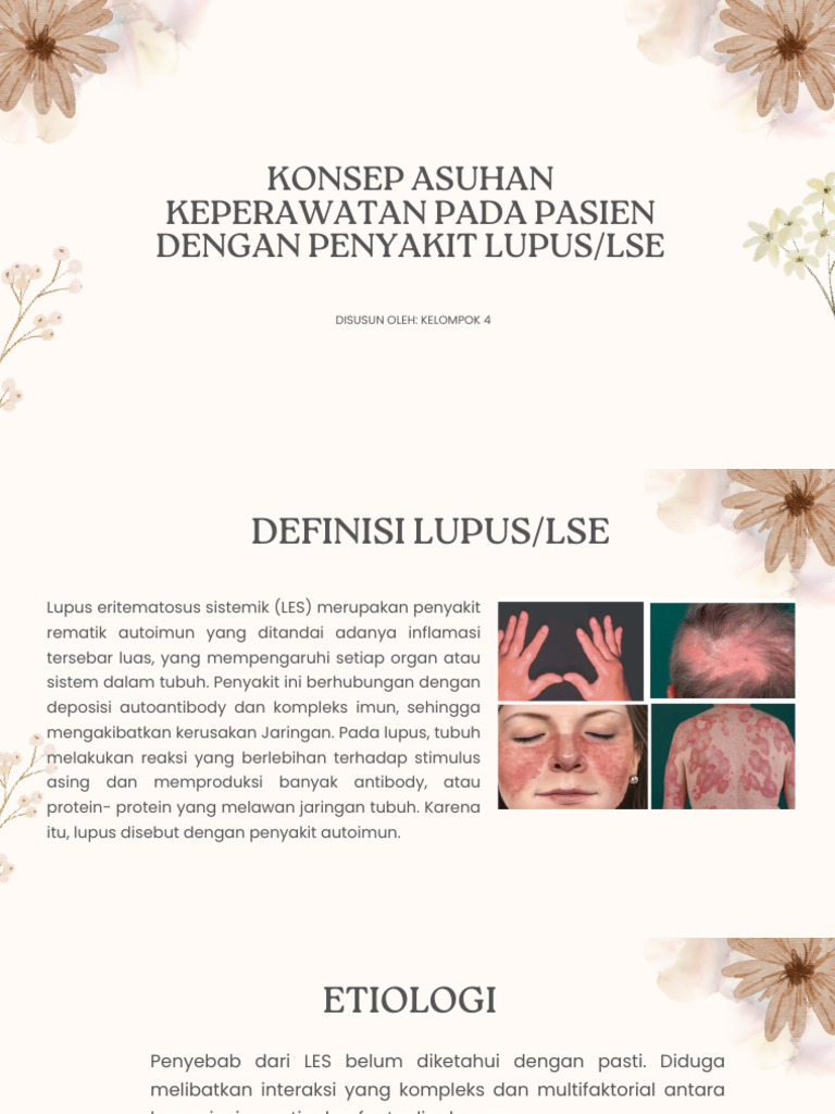 TK Ii - Kelompok 4 - PPT - Lupus Atau Lse | PDF