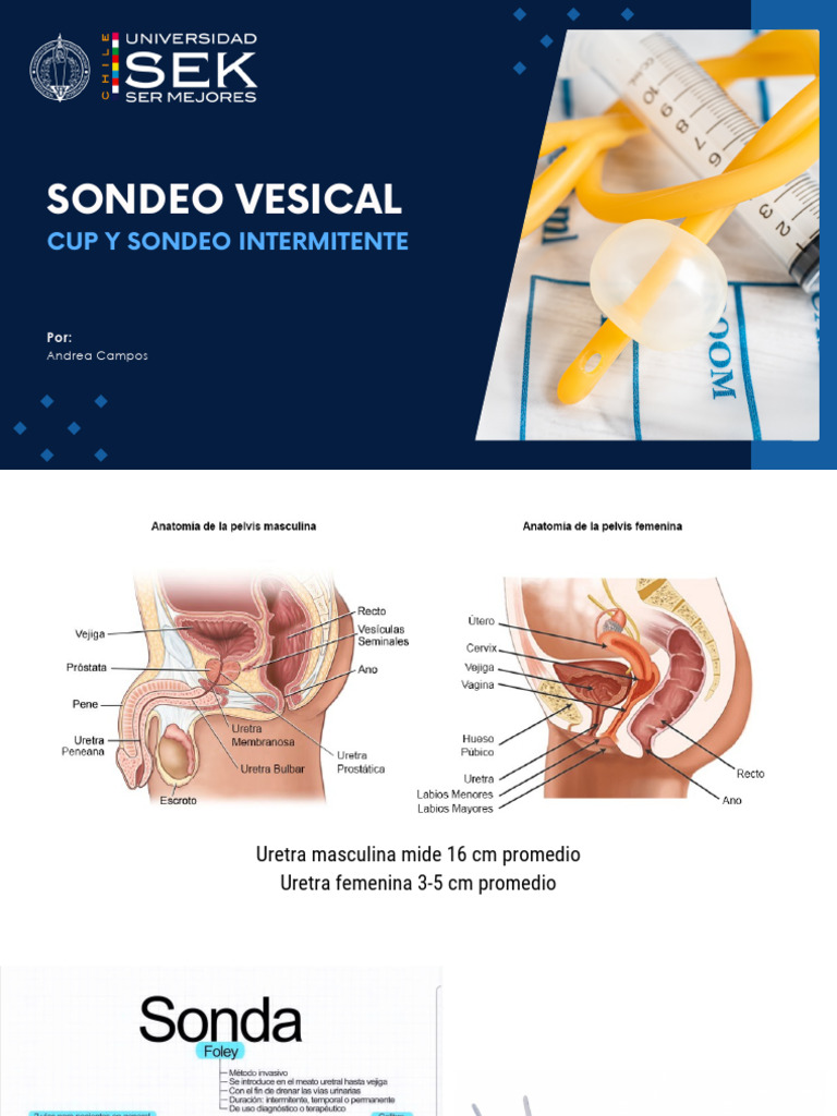 Clase 4B Sondeo Vesical Cup | PDF | Urología | Sistema genitourinario