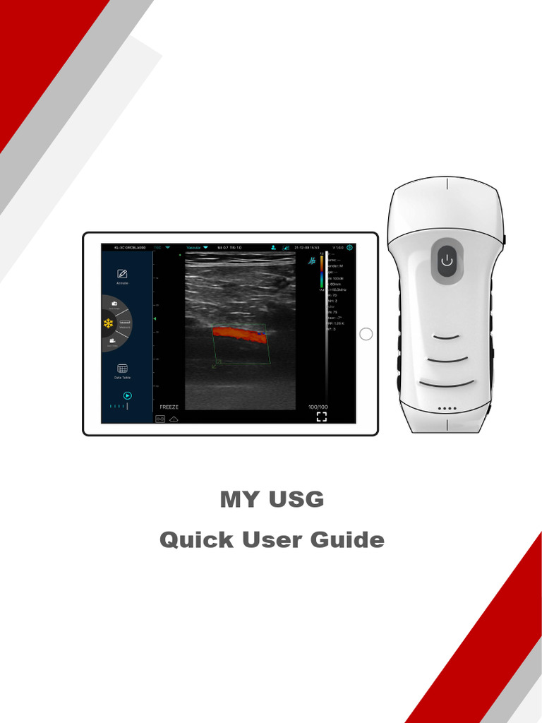 MyUSG Quick User Manual - V1.0 | PDF | Ammonium | Salt (Chemistry)