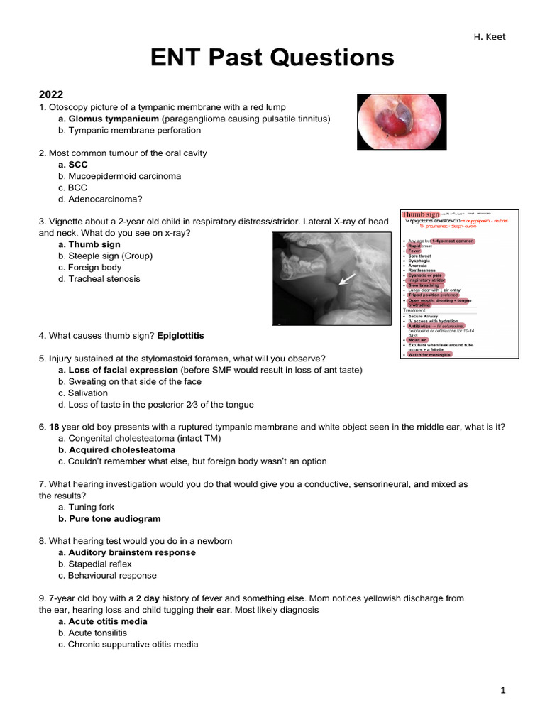 ENT Exam Practice Questions 2022 | PDF | Ear | Human Nose