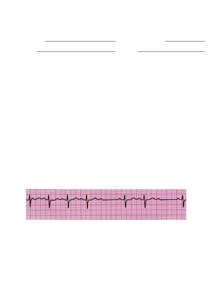 Basic ECG Interpretation 2020 | PDF | Electrocardiography | Cardiology