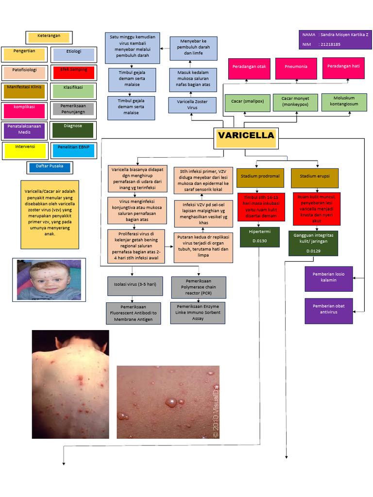 WOC Varicella 1 | PDF