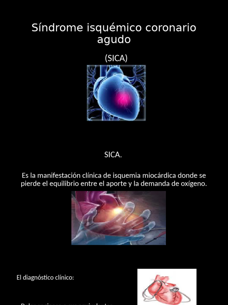 4 Síndrome Isquémico Coronario Agudo | PDF | Isquemia | Infarto de ...