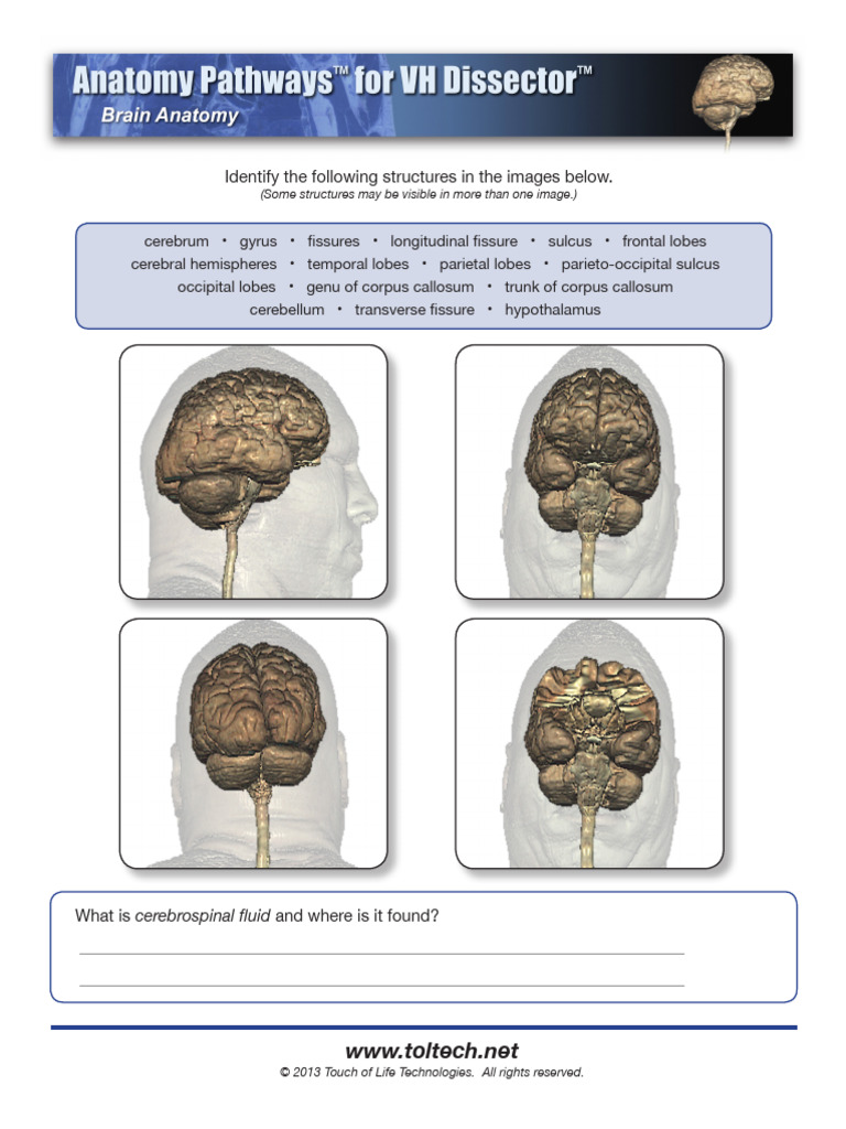 Transverse Fissure in Brain Anatomy | PDF