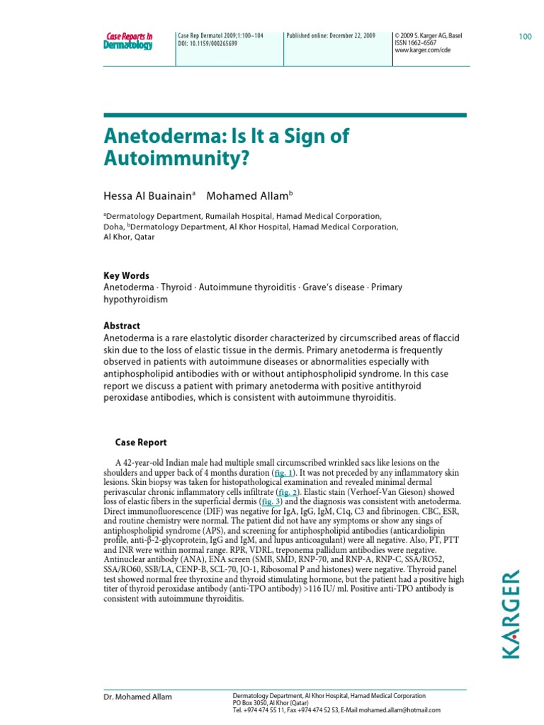 Anetoderma: Is It A Sign of Autoimmunity?: Hessa Al Buainain Mohamed ...