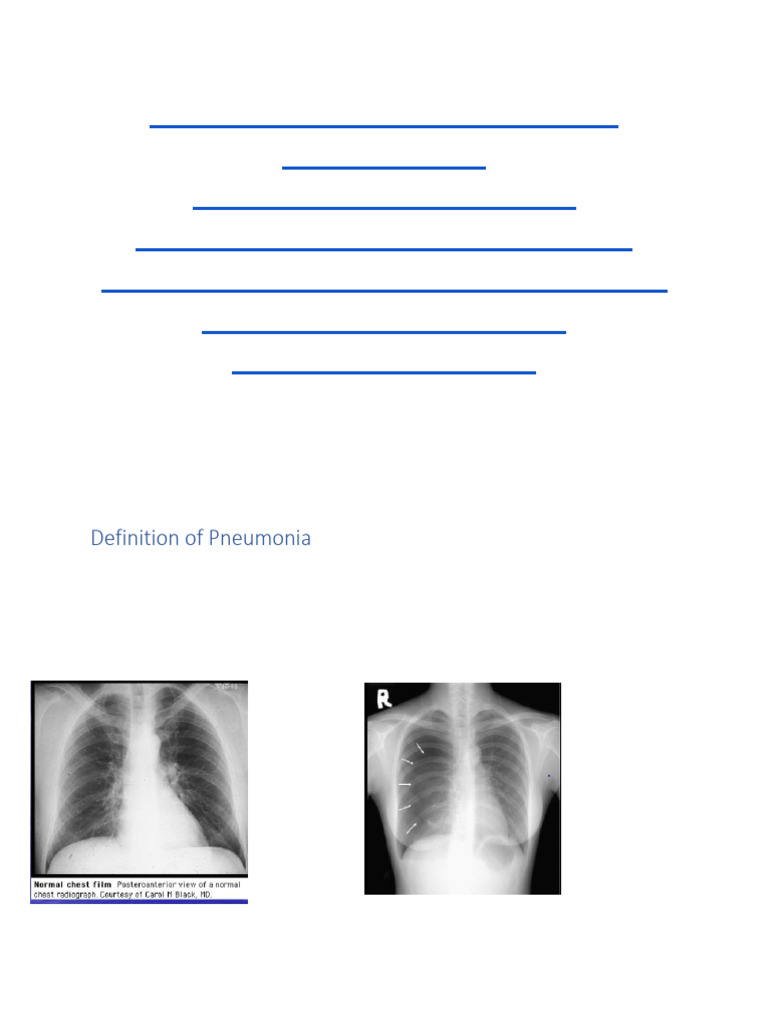 Pneumonia and Its Type and Detail Note On Management | PDF | Pneumonia ...