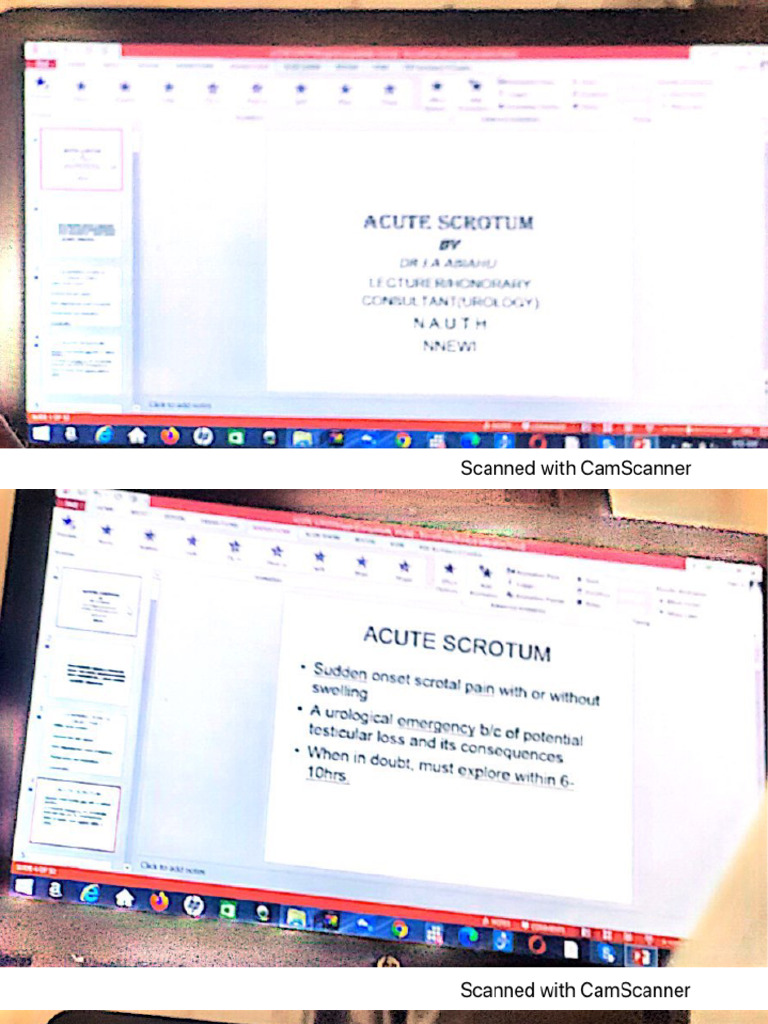 Acute Scrotum | PDF