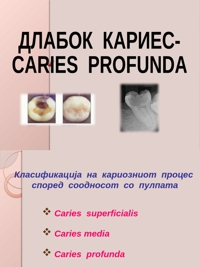Caries - Profunda 6 | PDF