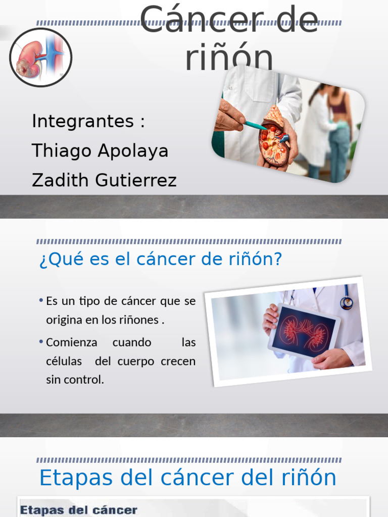 Cáncer de Riñón: Síntomas y Etapas | PDF