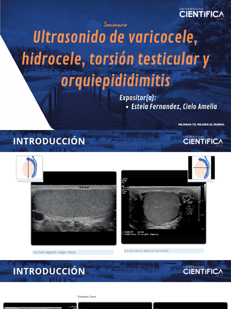 Ultrasonido de Varicocele, Hidrocele, Torsión Testicular y ...