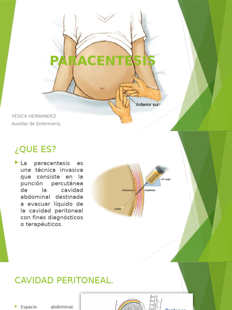 Guía Completa sobre Paracentesis Abdominal | PDF | Abdomen | Peritoneo
