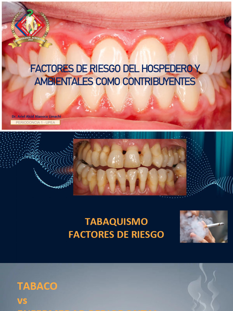 Tabaquismo y Enfermedad Periodontal | PDF | De fumar | Especialidades ...