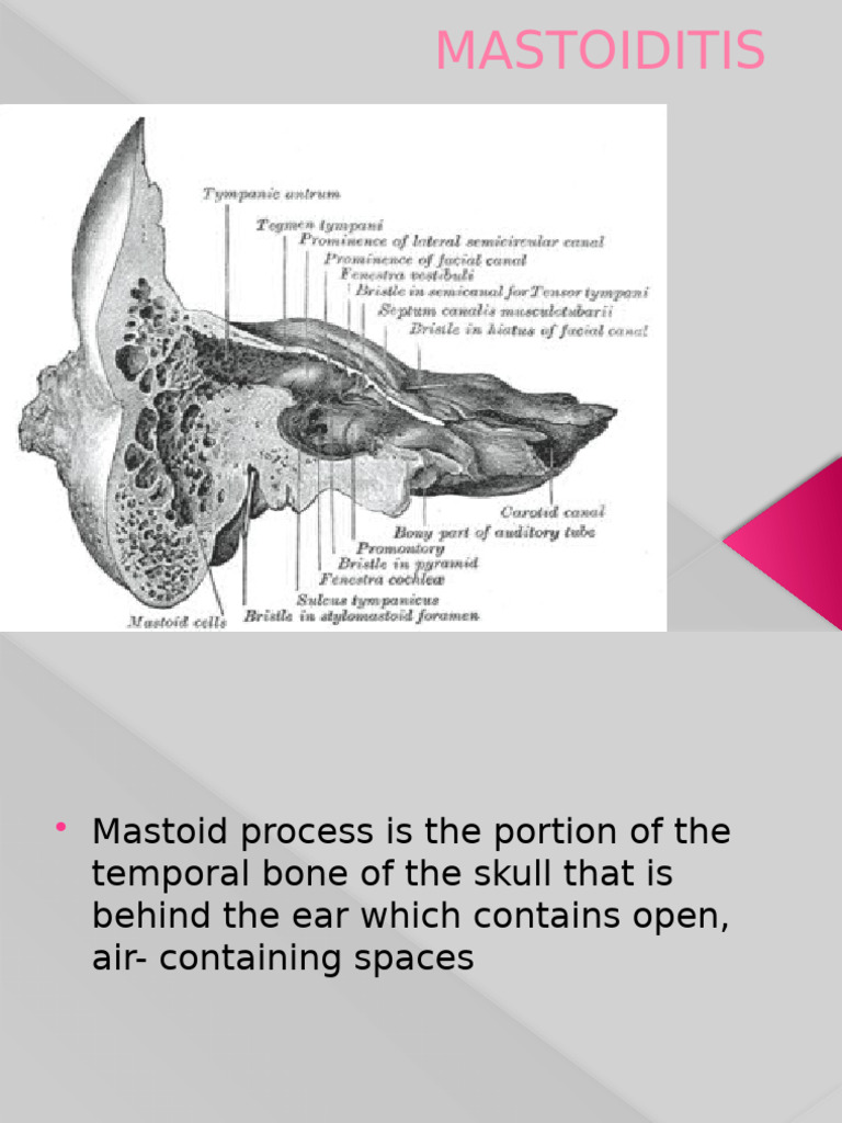 Mastoiditis | PDF | Ear | Diseases And Disorders