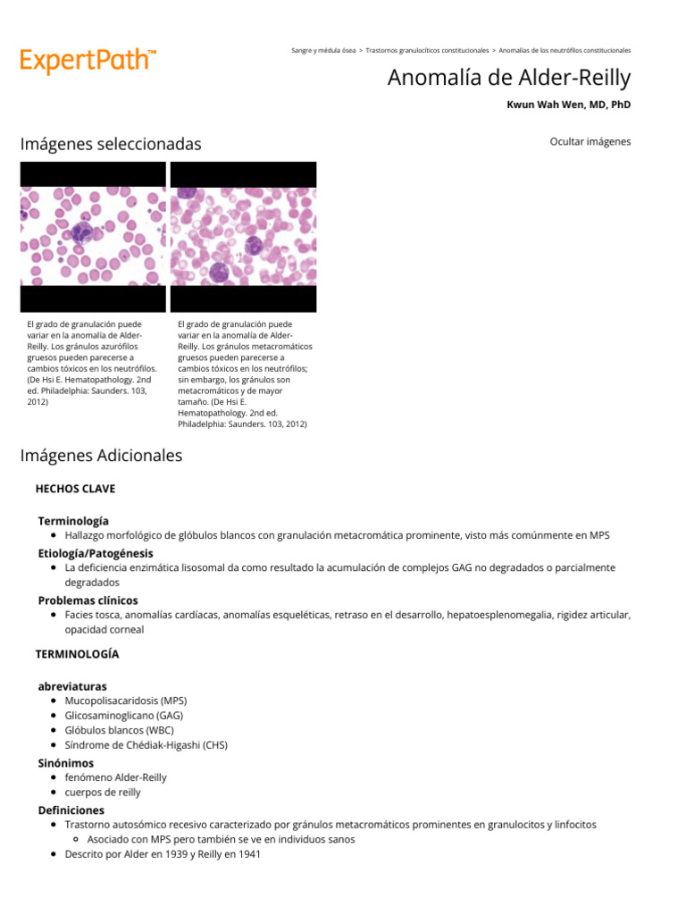 Anomalía de Alder-Reilly en Neutrófilos | PDF | Leucocito ...