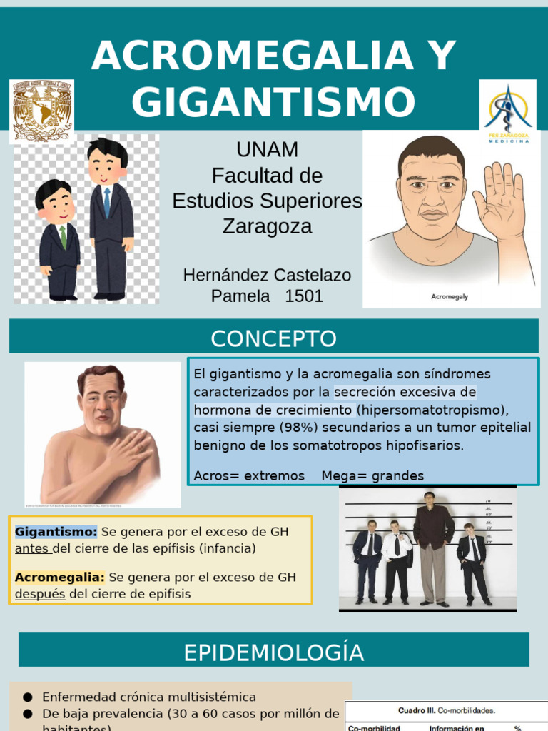 Gigantismo y Acromegalia: Diagnóstico y Tratamiento | PDF | Hormona de ...