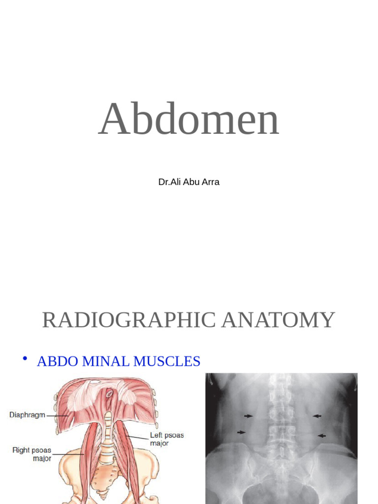 Abdominal Radiographic Anatomy Guide | PDF | Abdomen | Anatomy