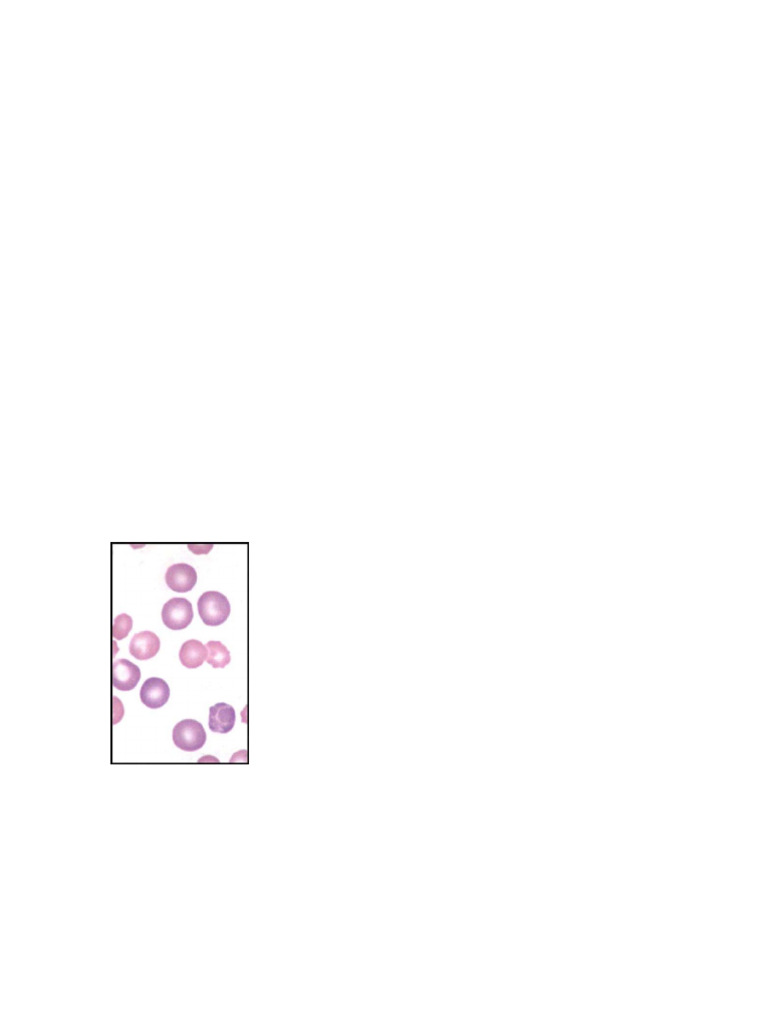 Erythrocytes Morfology Clues To An Underlying Cause For Disease | PDF ...