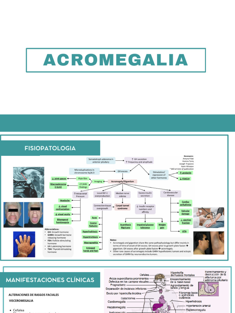 ACROMEGALIA | PDF | Medicina CLINICA | Enfermedades y trastornos