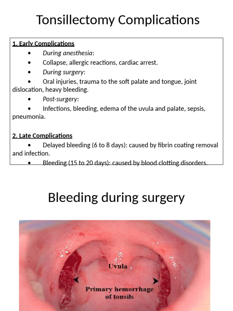 Tonsillectomy Complications 2 | PDF