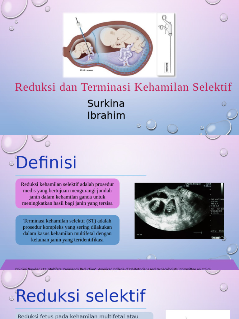 Reduksi Dan Terminasi | PDF | Sains & Matematika