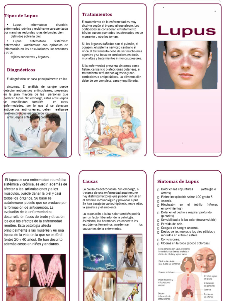 Triptico LUPUS | PDF | Epidemiología | Medicina