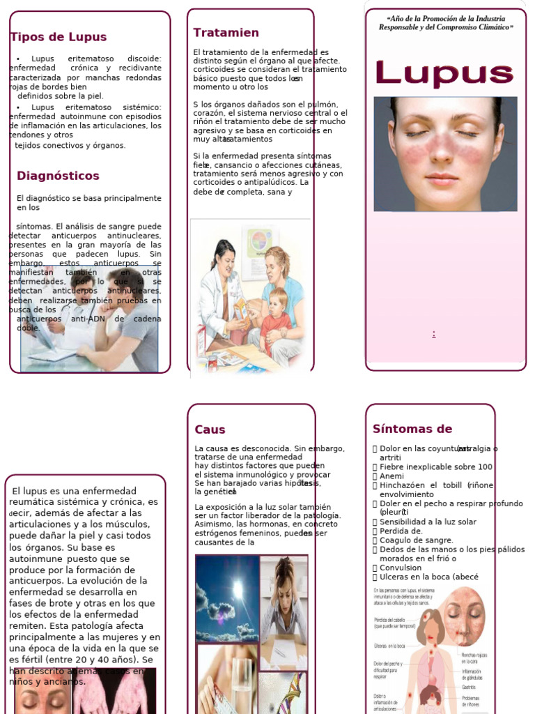 Guía del Lupus: Tipos, Diagnóstico y Tratamiento | PDF | Inmunología ...