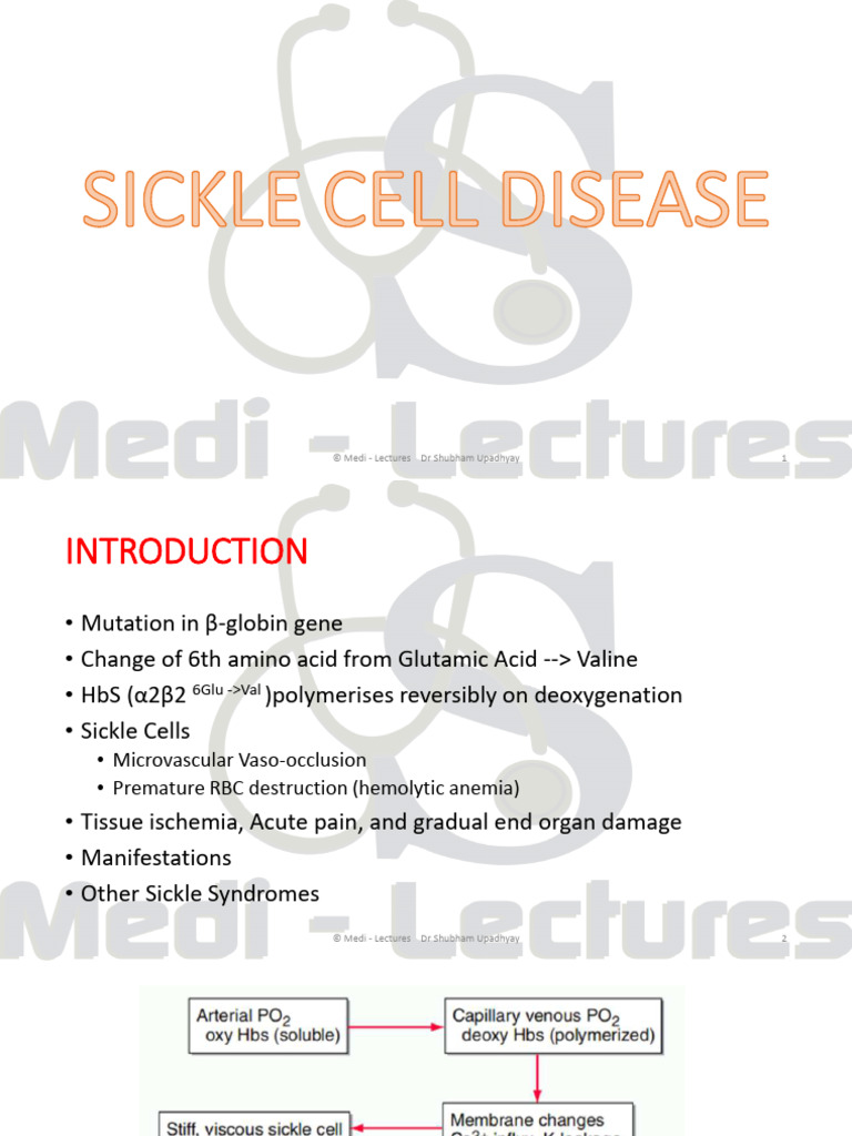 Sickle Cell Disease | PDF