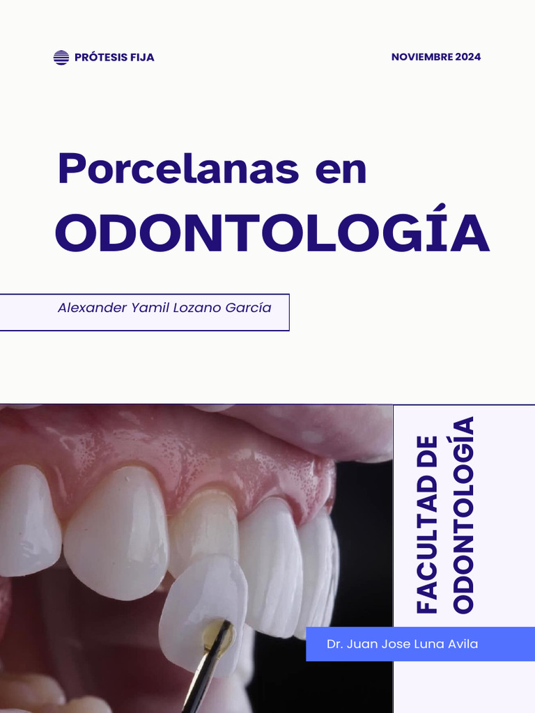 Porcelana S | PDF | Aluminio | Cerámica